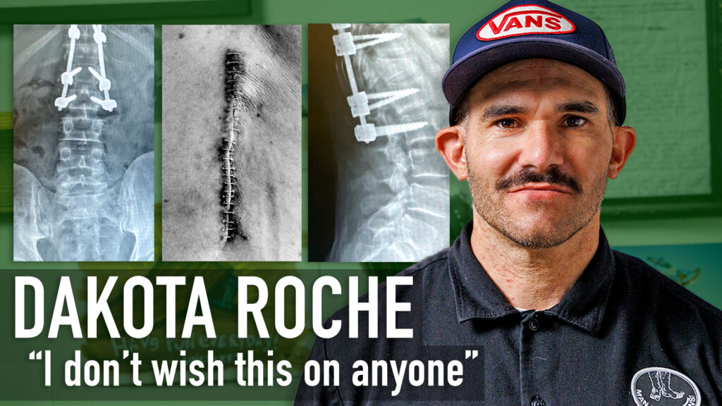 DAKOTA ROCHE – UNCLICKED – Our BMX